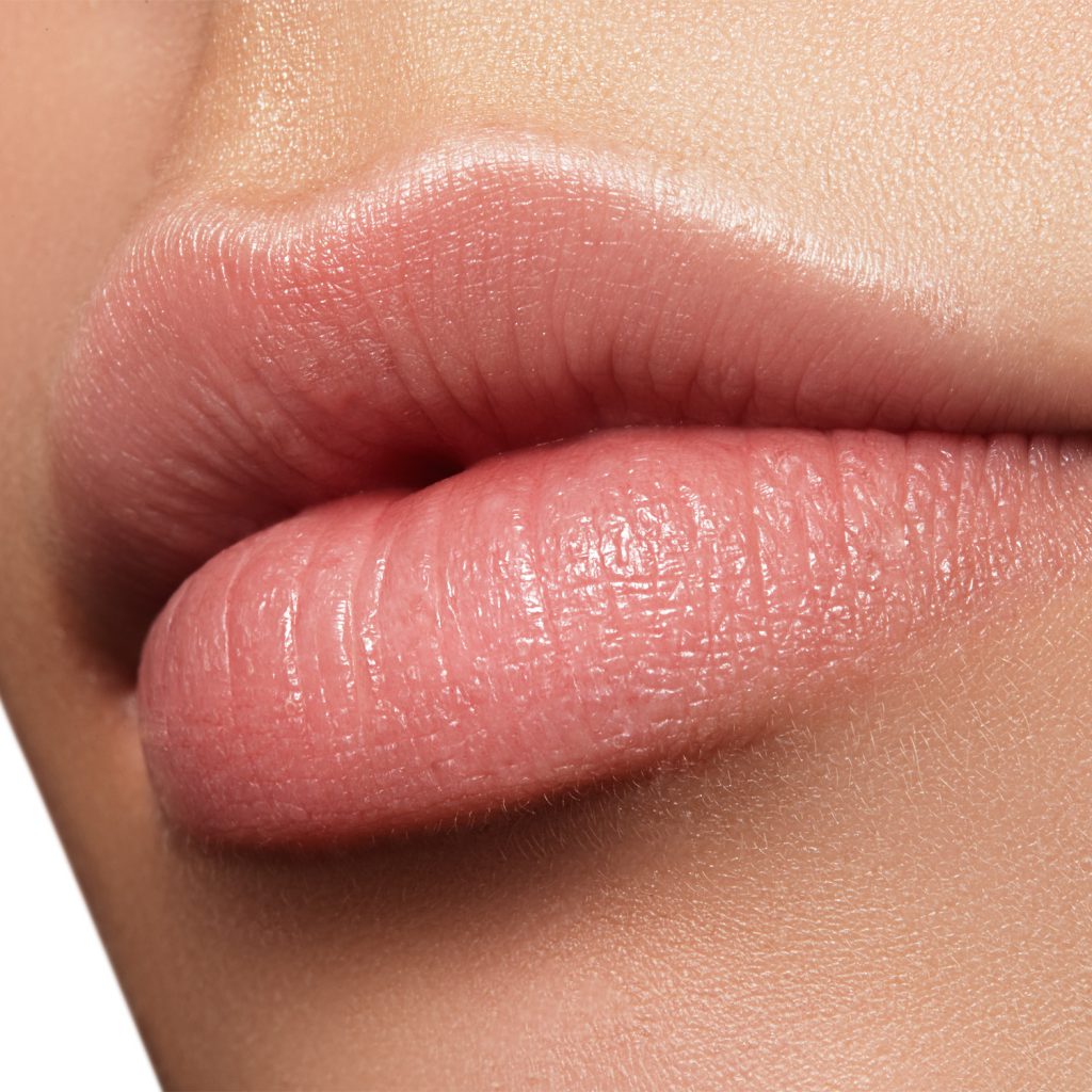 Rides péri buccale – Plasma Clinic