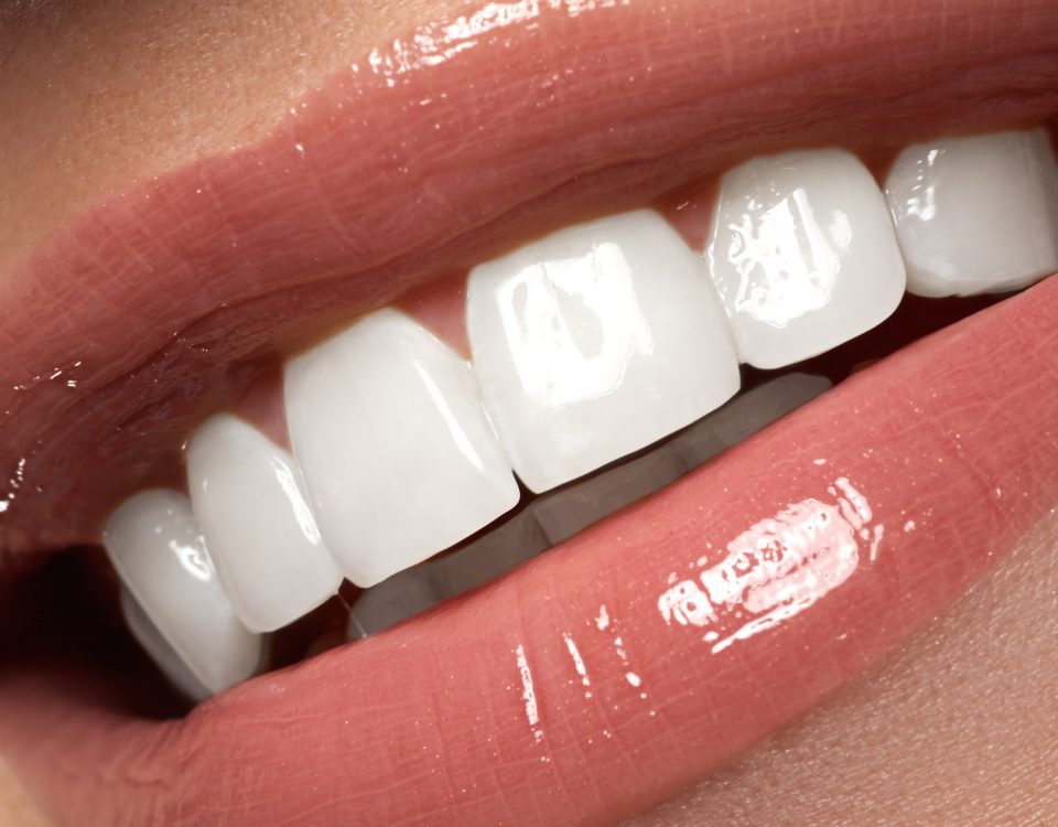 Étage inférieur du visage - Plasma Clinic